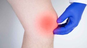 Dolore ginocchio interno: cause e rimedi efficaci | Fisiosocial